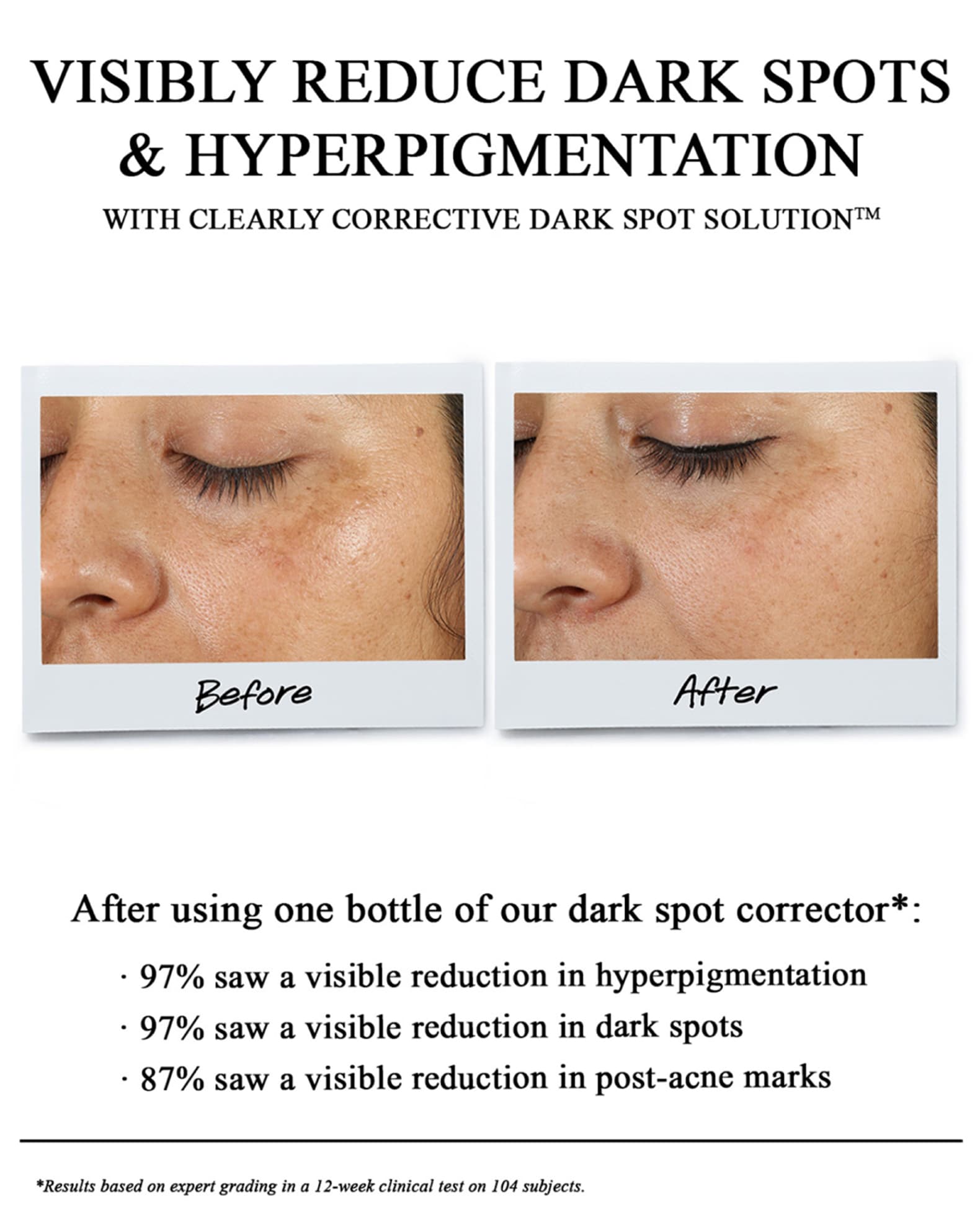 Clearly Corrective Dark Spot Solution | Neiman Marcus