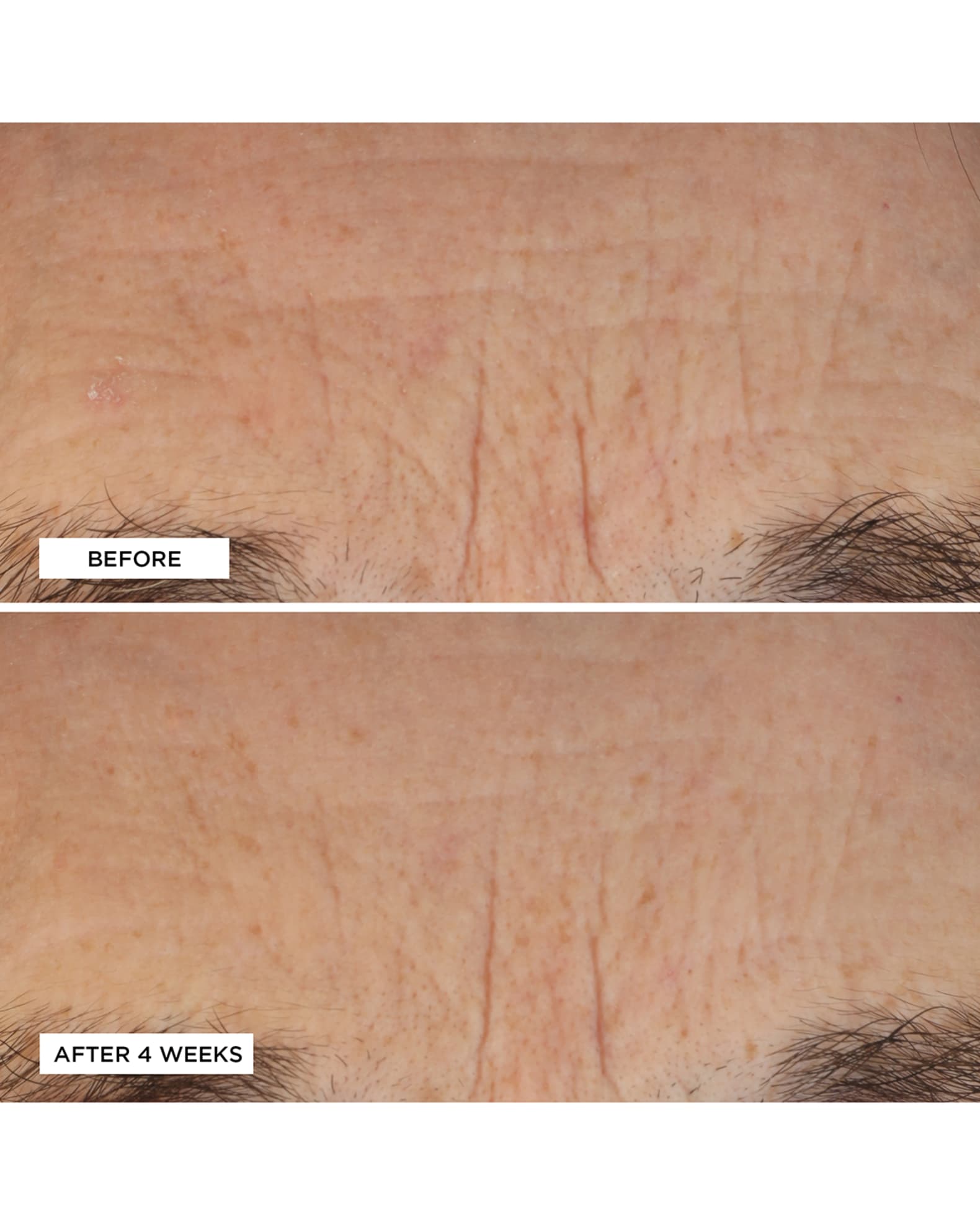 Perricone MD Essential Fx Acyl-Glutathione Deep Crease Serum, 1.0 oz ...