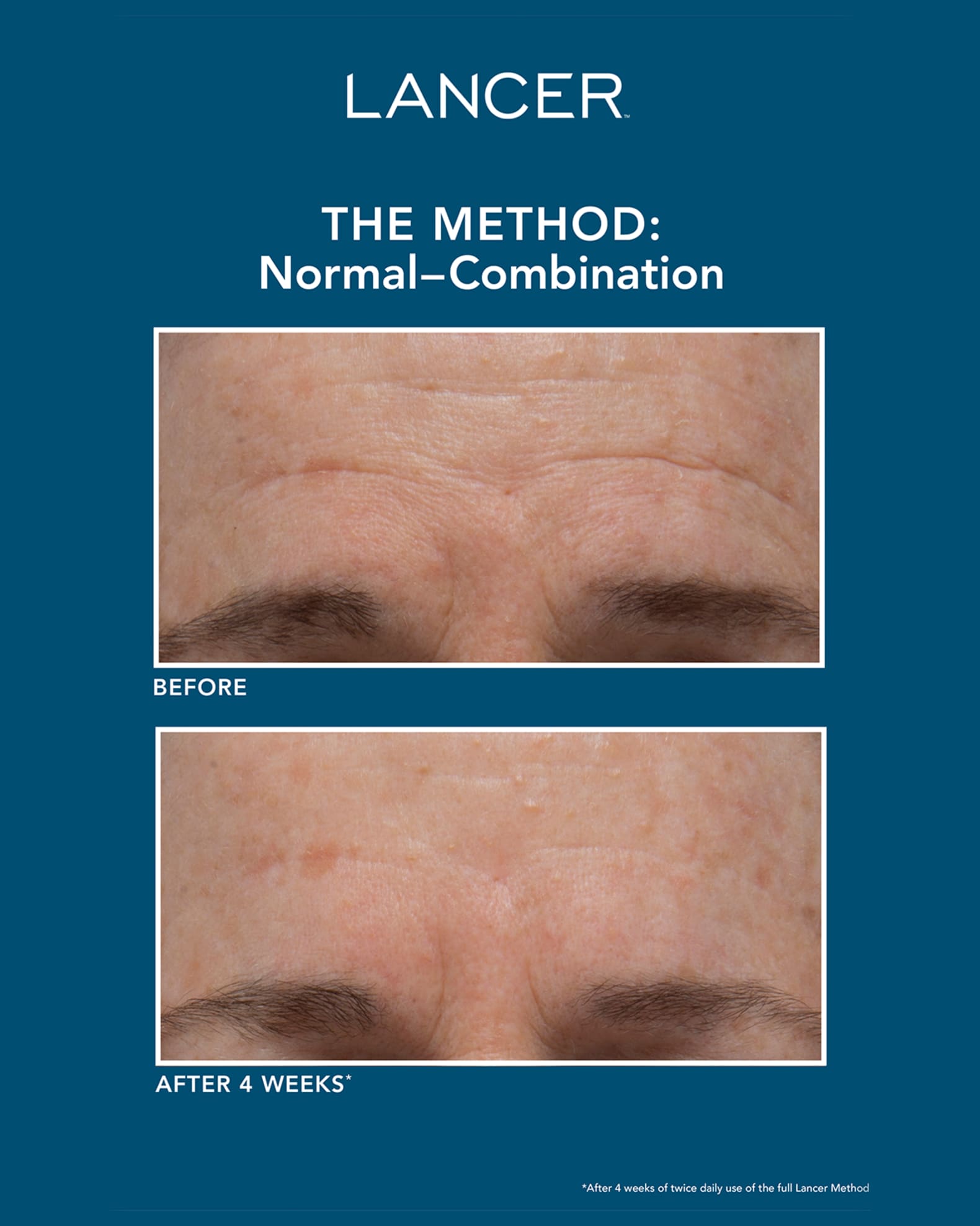 Lancer The Lancer Method Normal Combination Skin Set | Neiman Marcus
