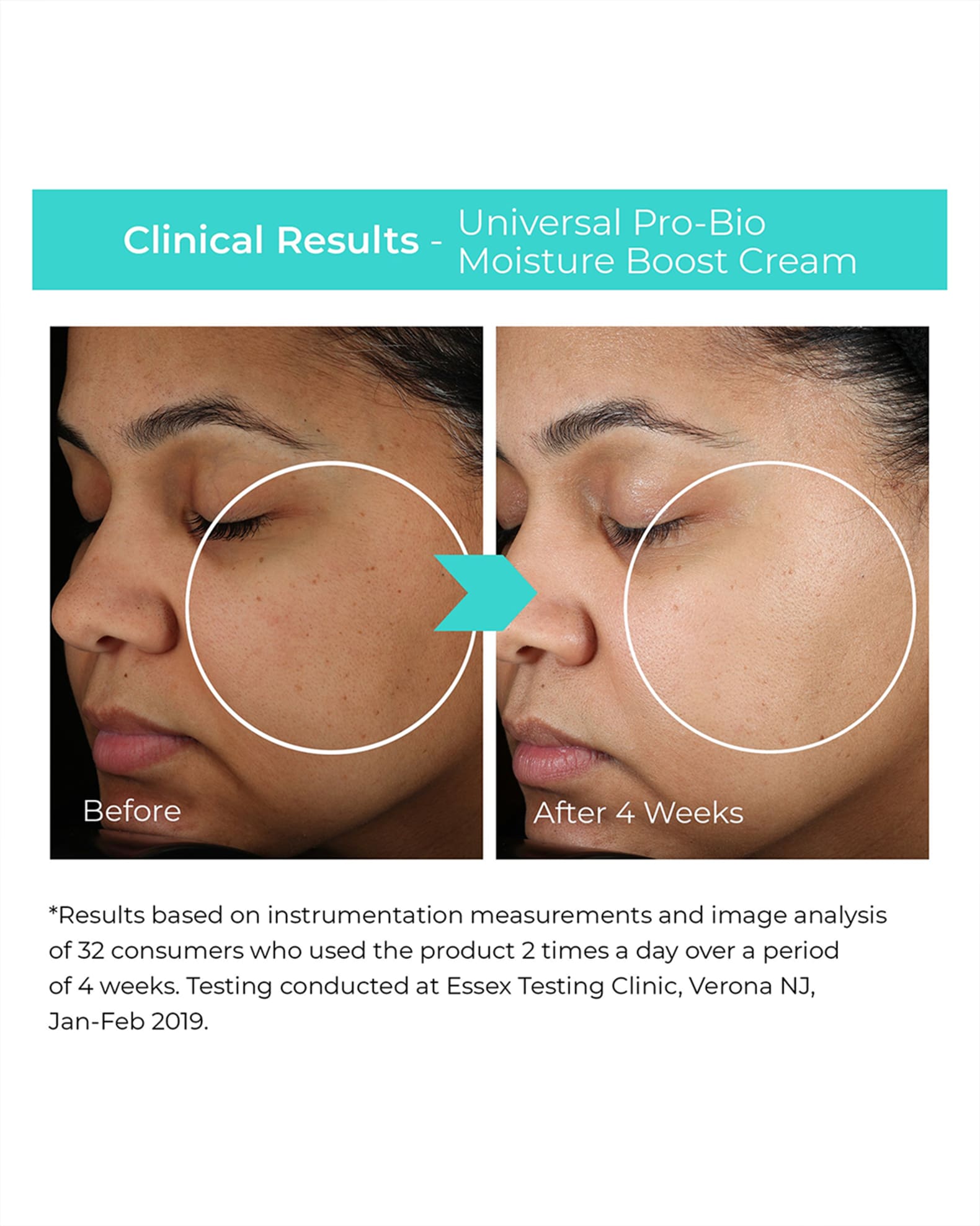 BeautyStat Universal Pro-Bio Moisture Boost Cream, 1 oz. | Neiman Marcus