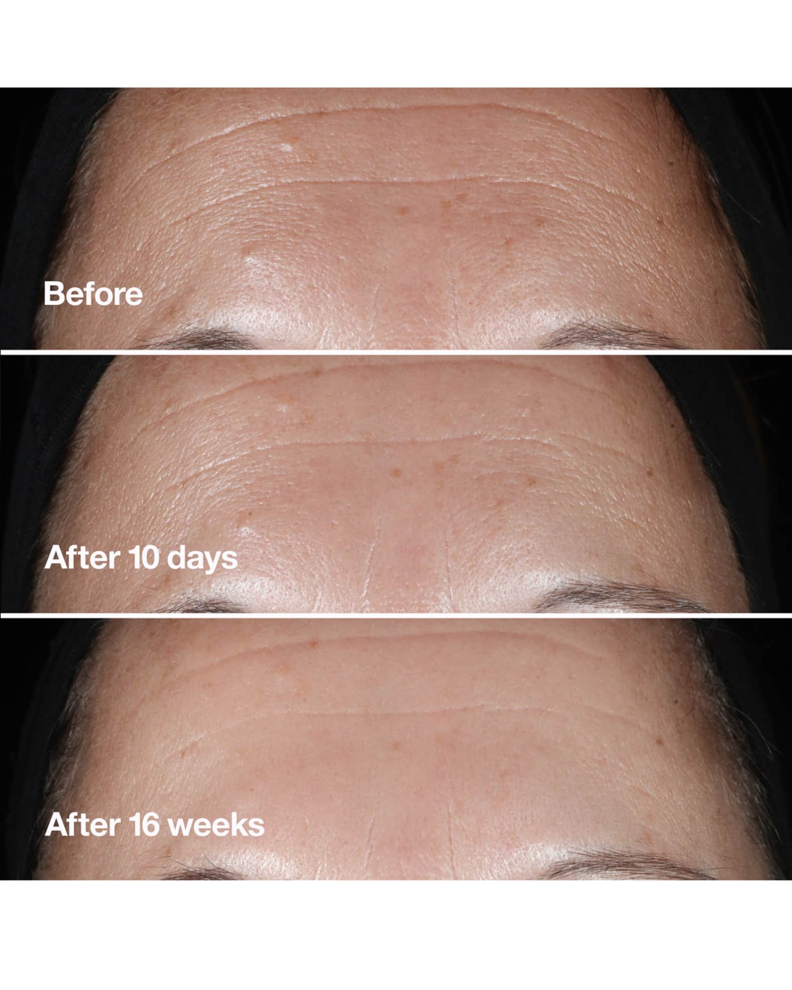 Clinique Smart Clinical Repair Serum, 1 oz. | Neiman Marcus