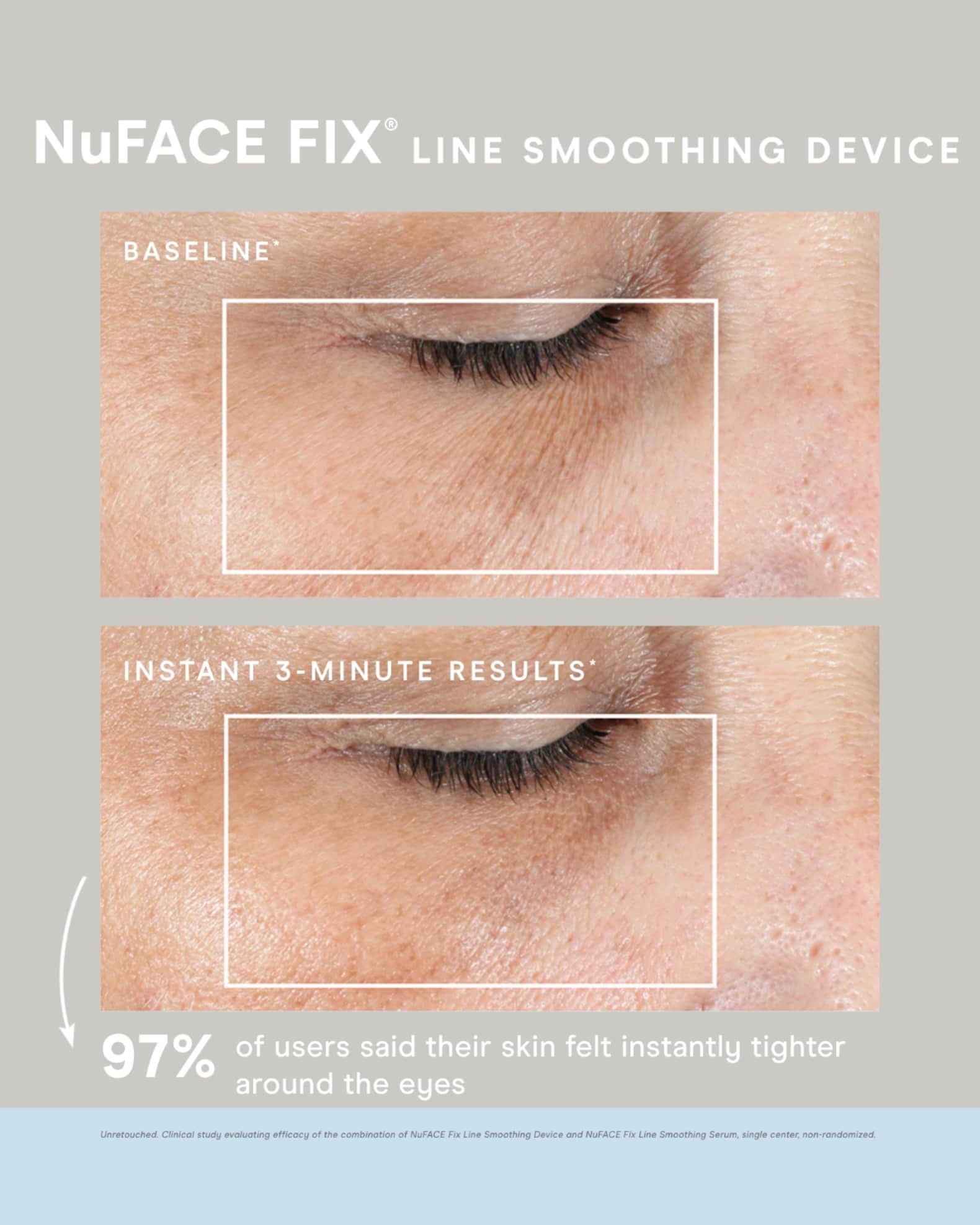 NuFace Fix Device with Serum | Neiman Marcus