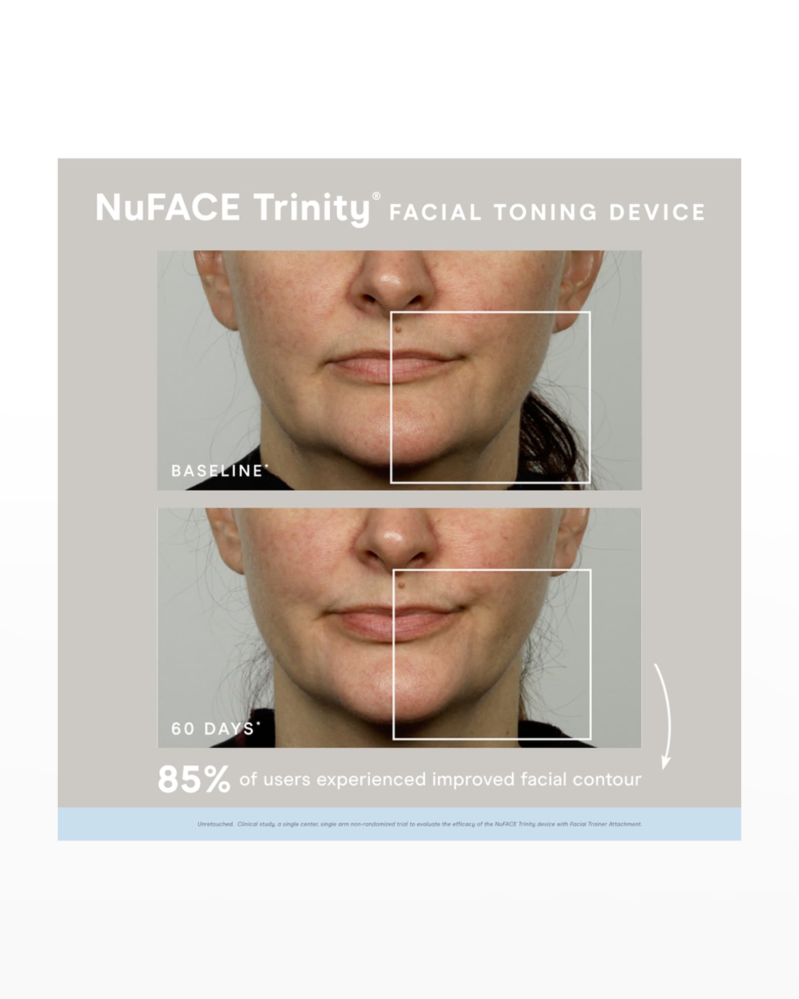 NuFace NuFace Trinity Supercharged Skincare Routine | Neiman Marcus