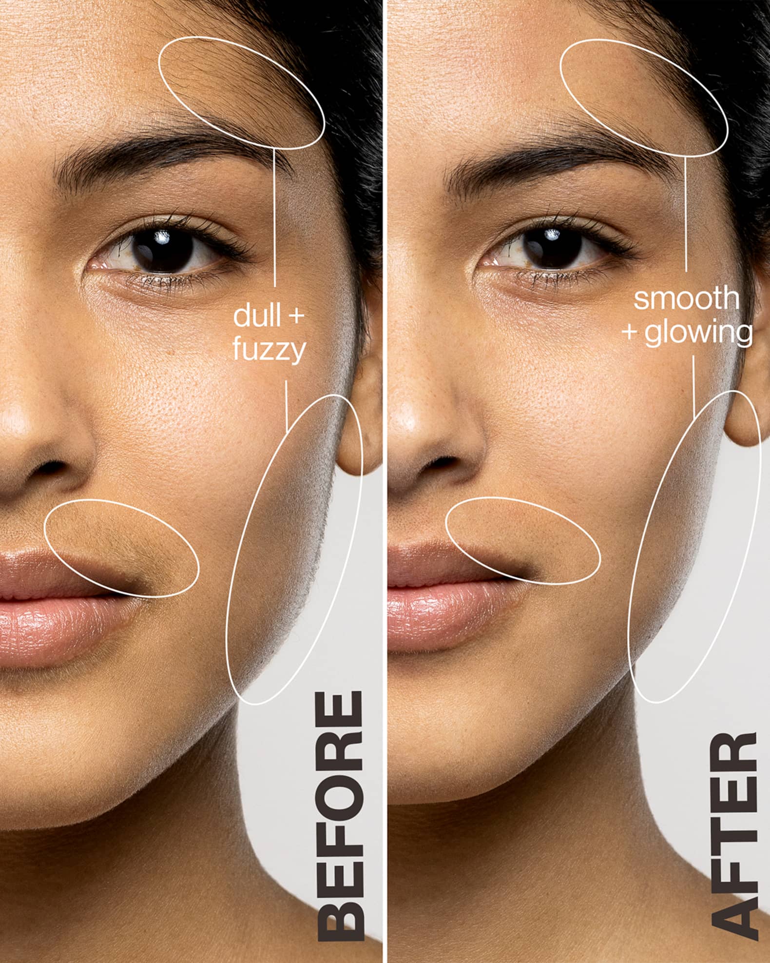 DERMAFLASH LUXE+ Sonic Dermaplaning & Peach Fuzz Removal | Neiman Marcus