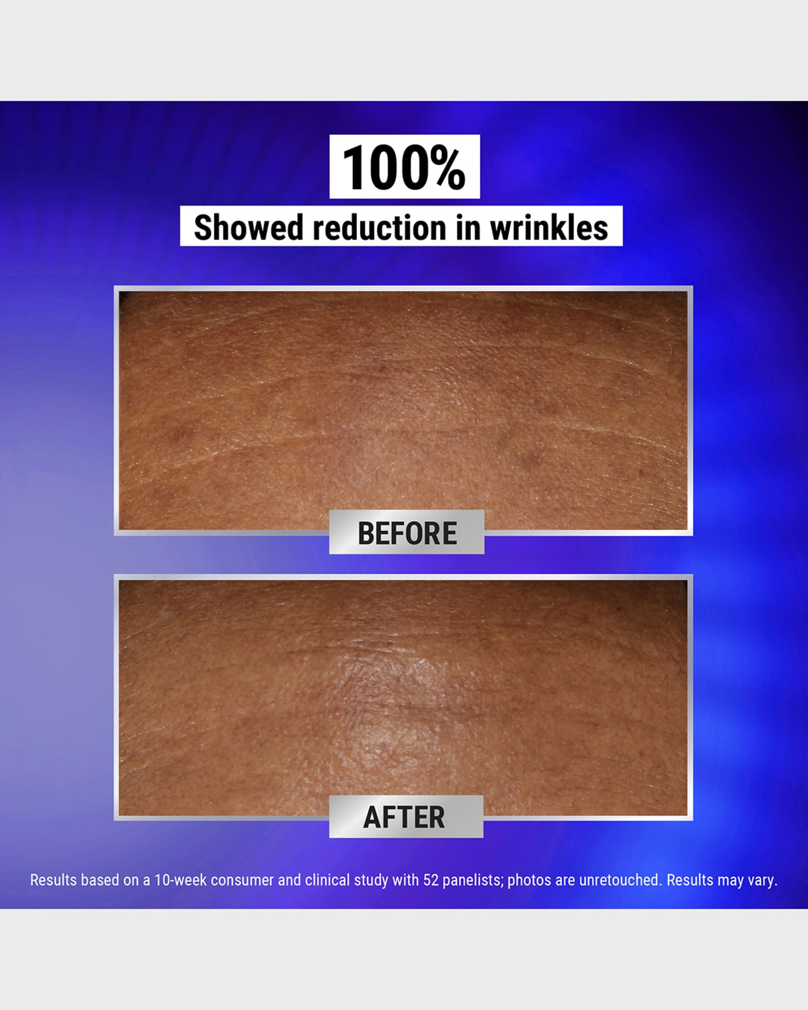 Kiehl's Since 1851 Retinol Fast Release Wrinkle-Reducing Night Serum, 0 ...