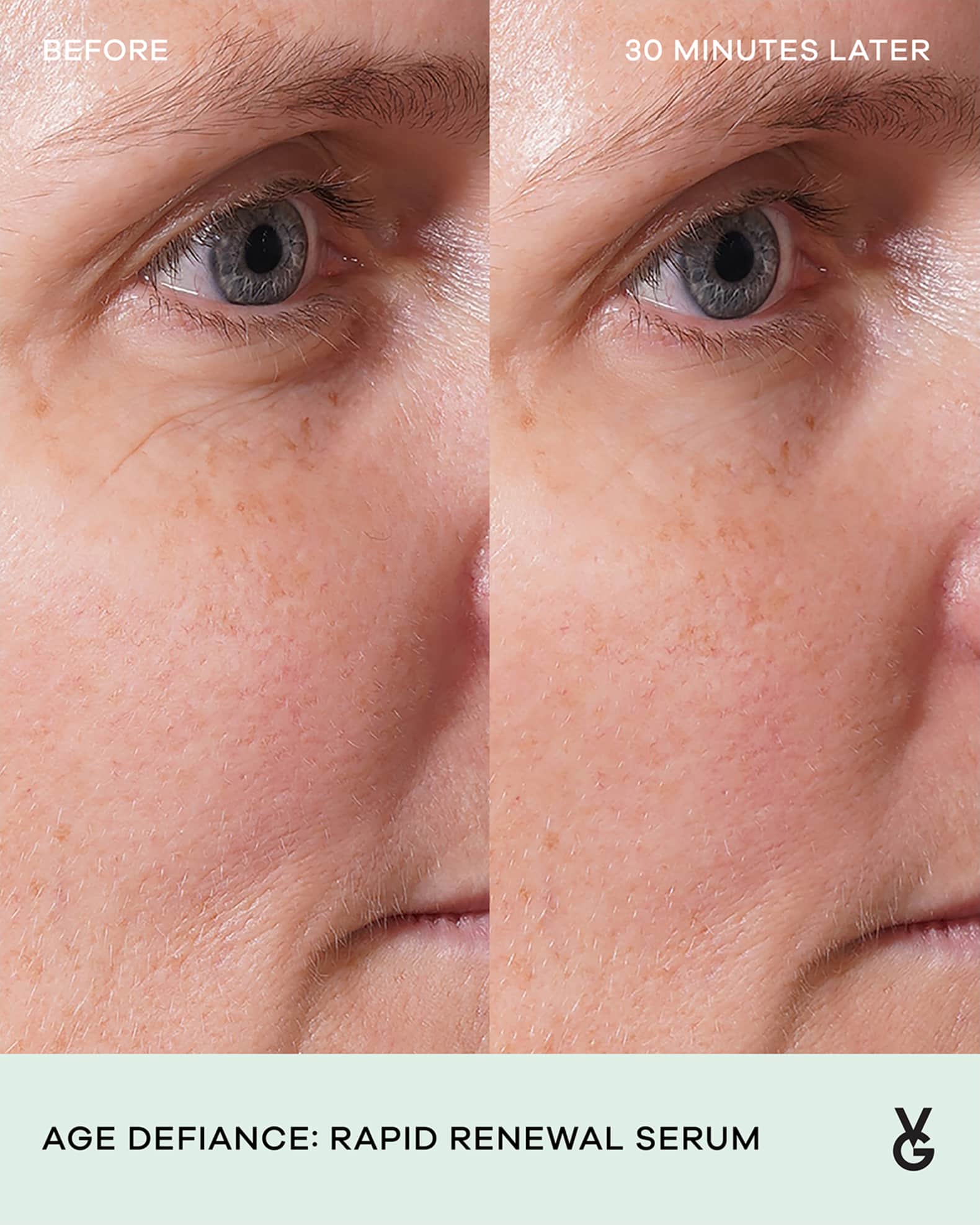 Vida Glow Rapid Renewal Serum | Neiman Marcus