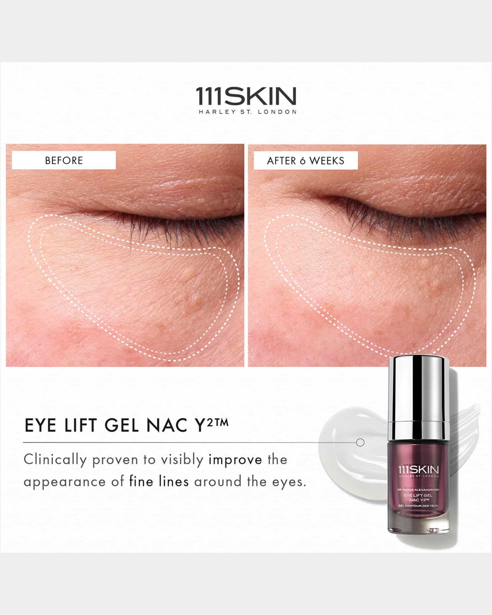 111SKIN Eye Lift Gel NAC Y2, 0.5 oz. | Neiman Marcus