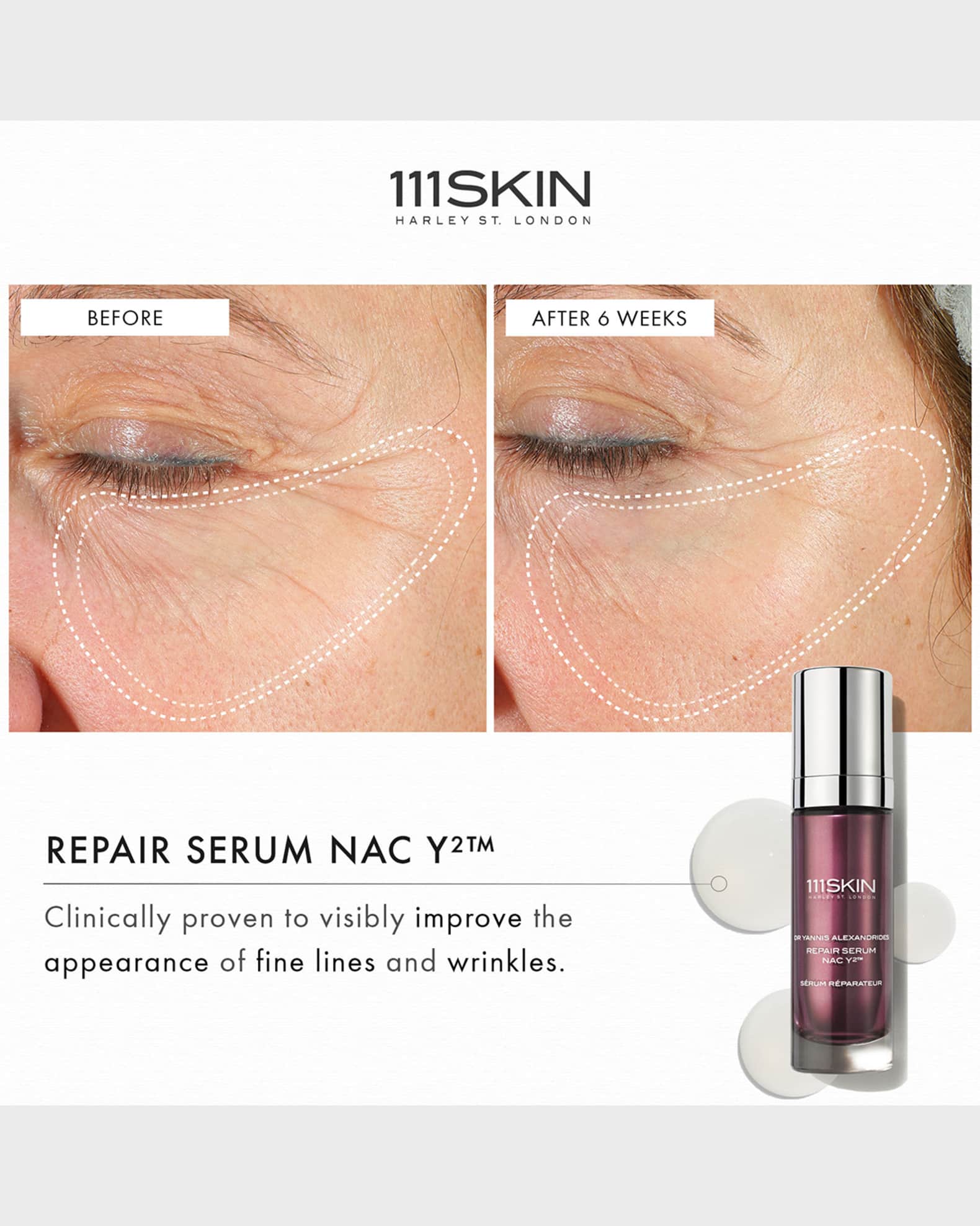 111SKIN Repair Serum NAC Y2, 1 oz. | Neiman Marcus