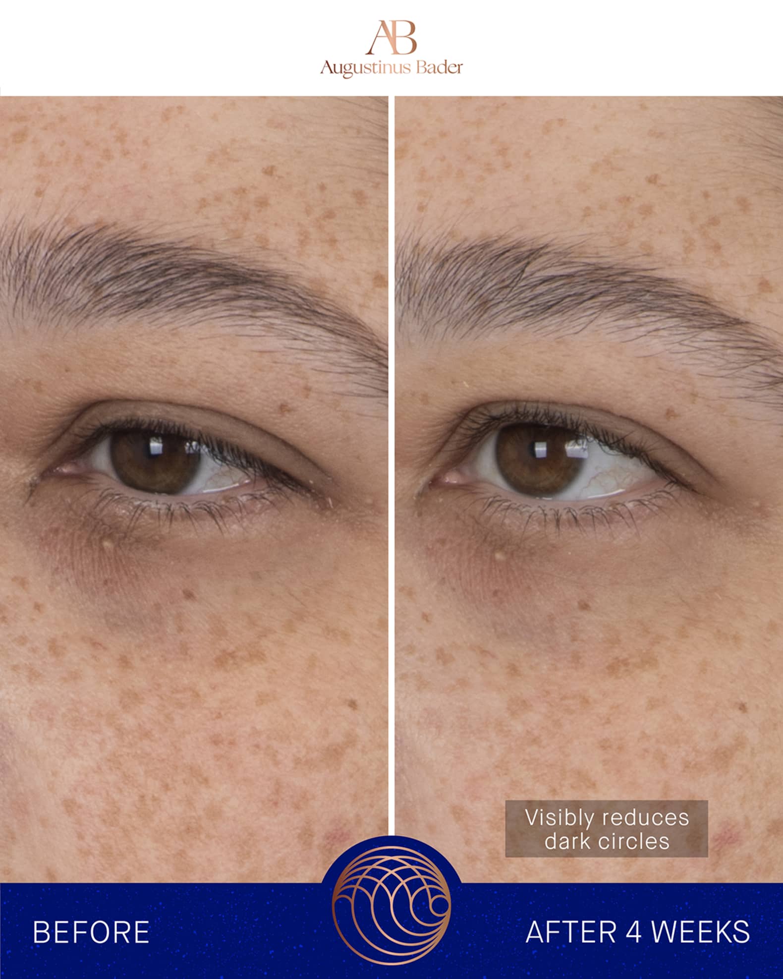 Augustinus Bader The Eye Patches with TFC8 | Neiman Marcus