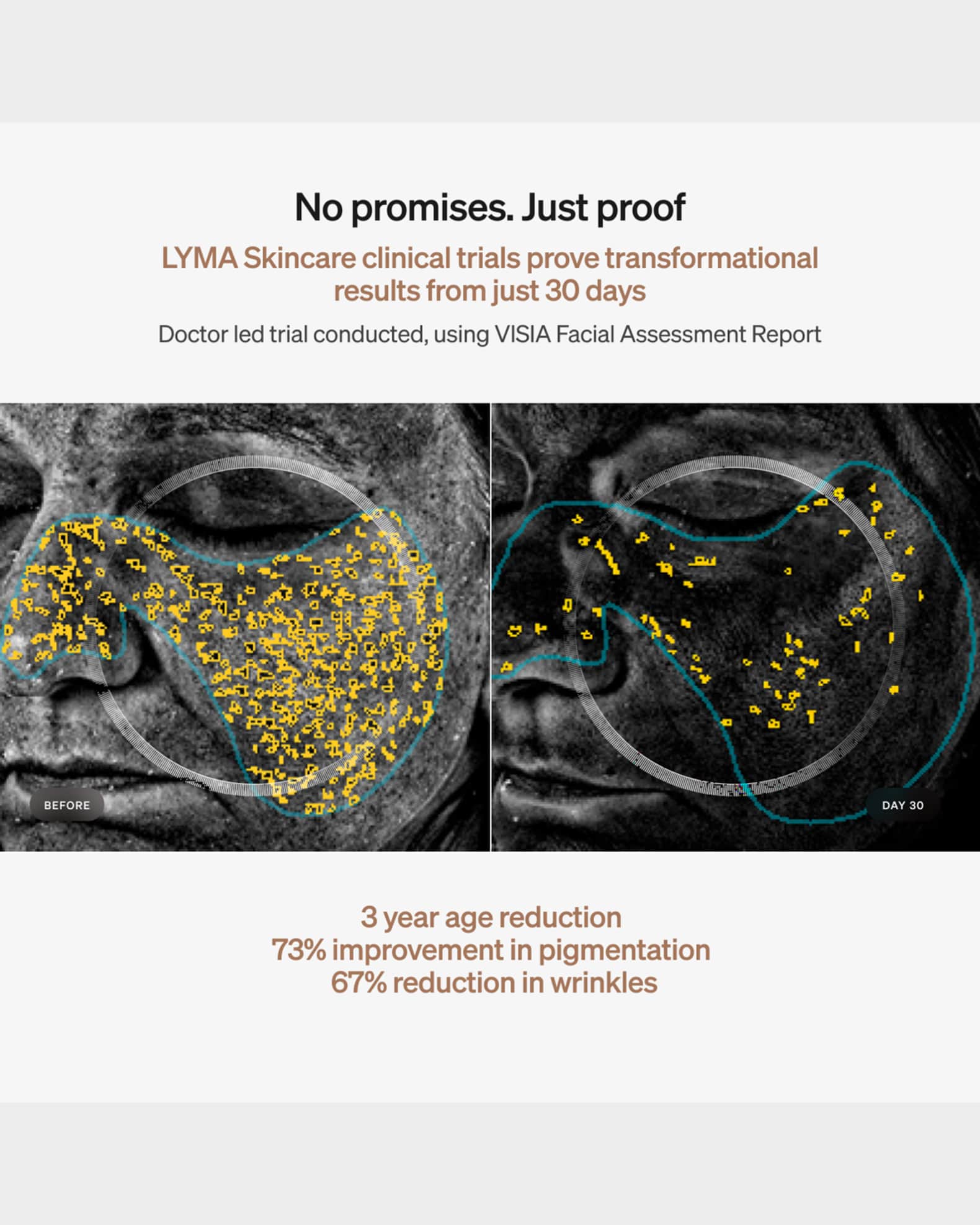 LYMA Skin Serum and Cream Starter Kit | Neiman Marcus