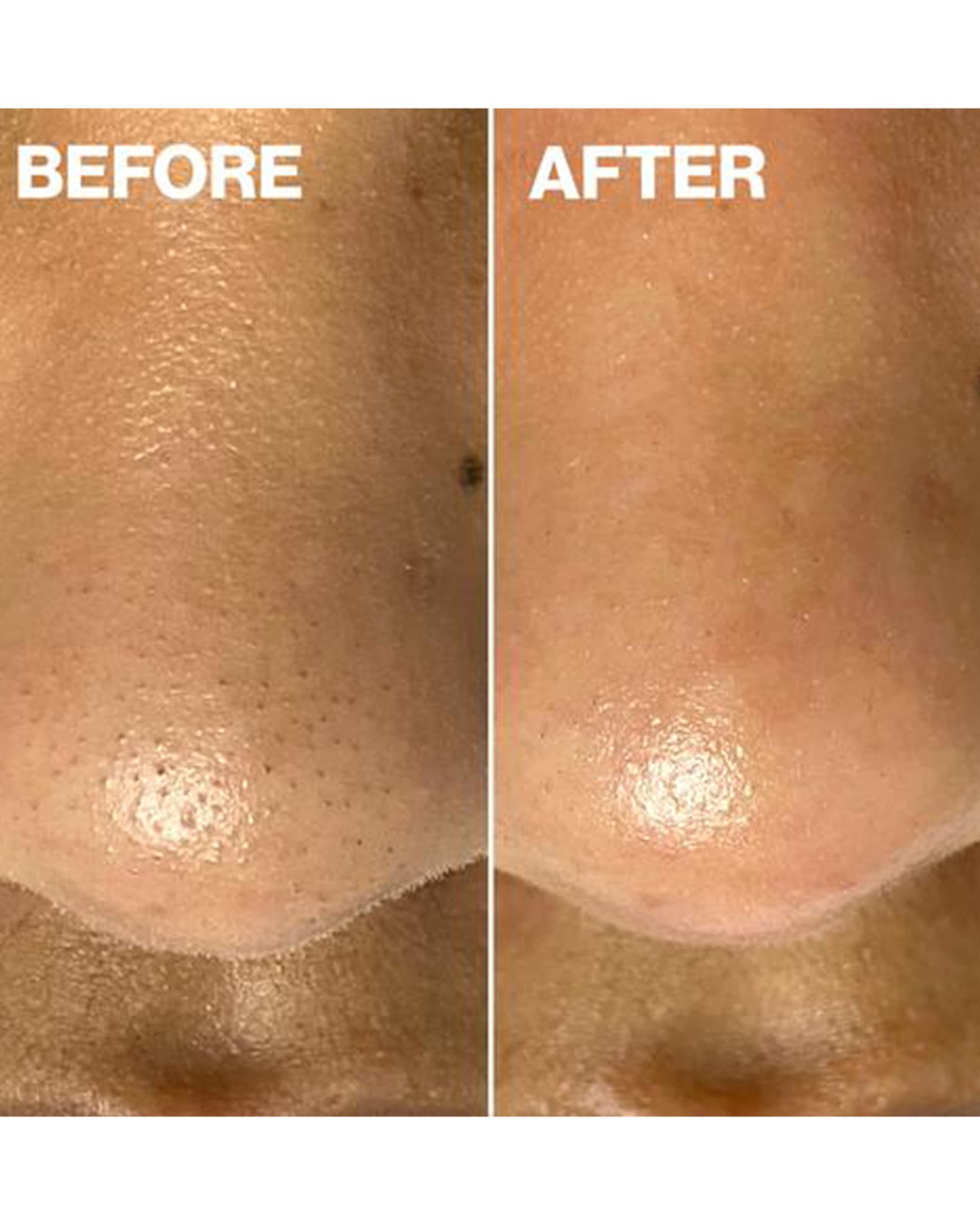 DERMAFLASH DERMAPORE+ Ultrasonic Pore Extractor | Neiman Marcus