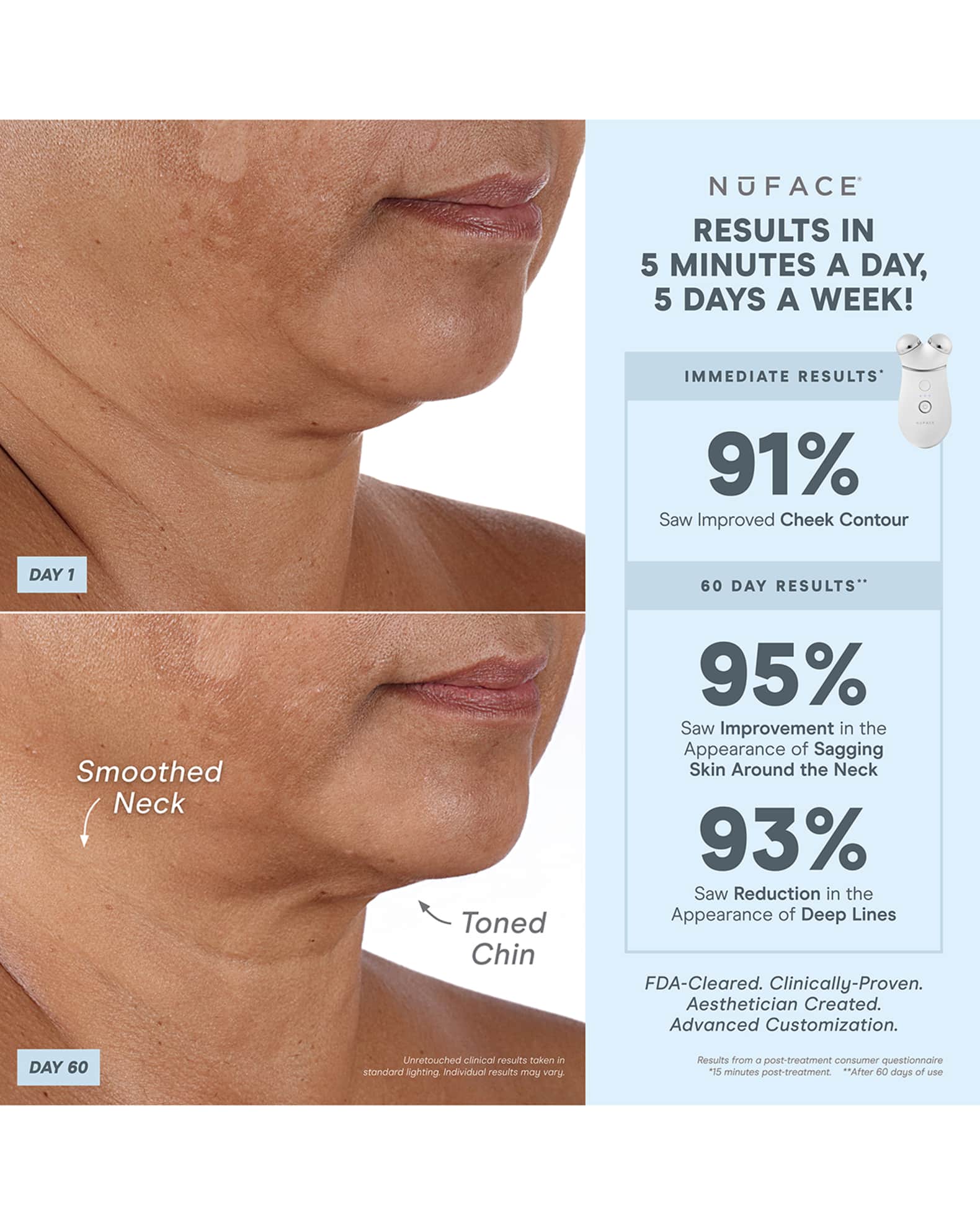 NuFace TRINITY+ Smart Advanced Facial Toning Routine | Neiman Marcus