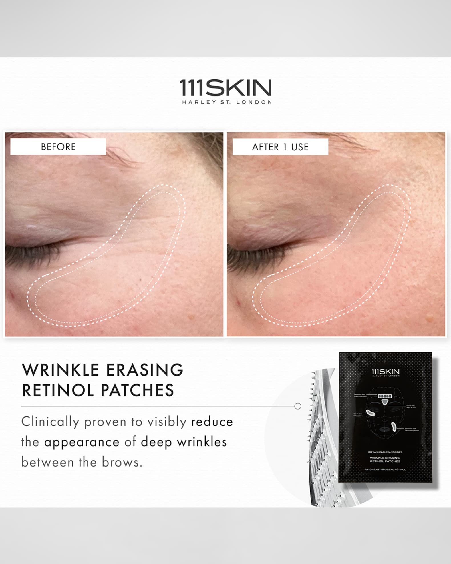 111SKIN Wrinkle Erasing Retinol Patches | Neiman Marcus