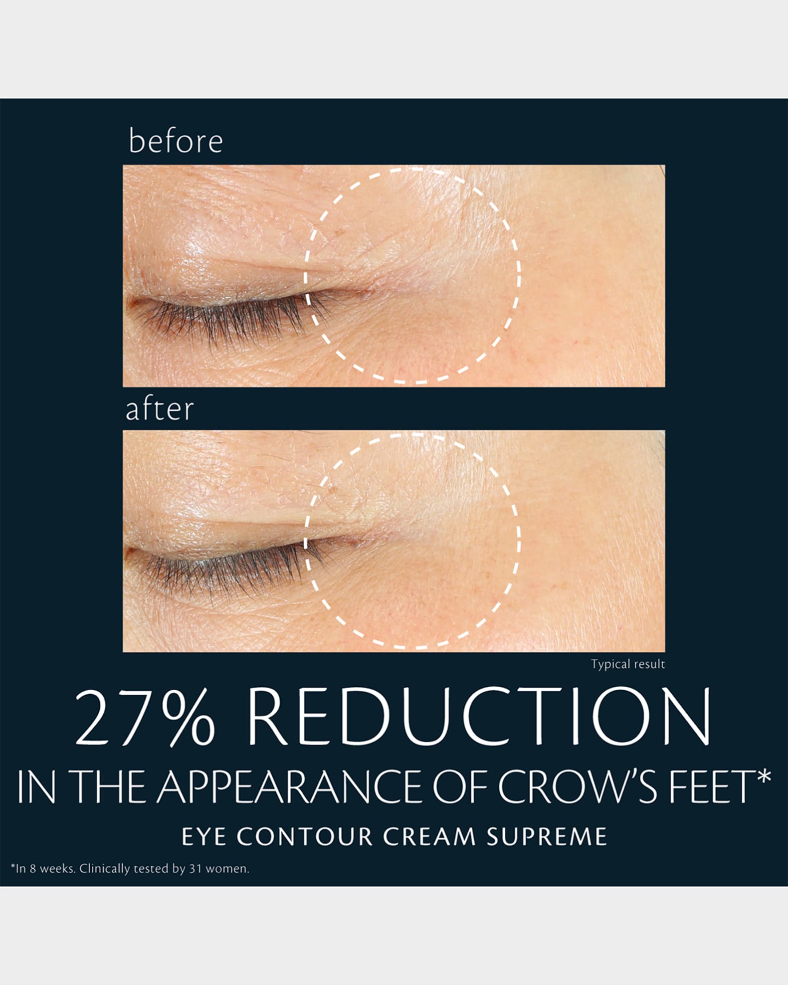 Cle de Peau Beaute Eye Contour Cream Supreme, 0.5 oz. | Neiman Marcus