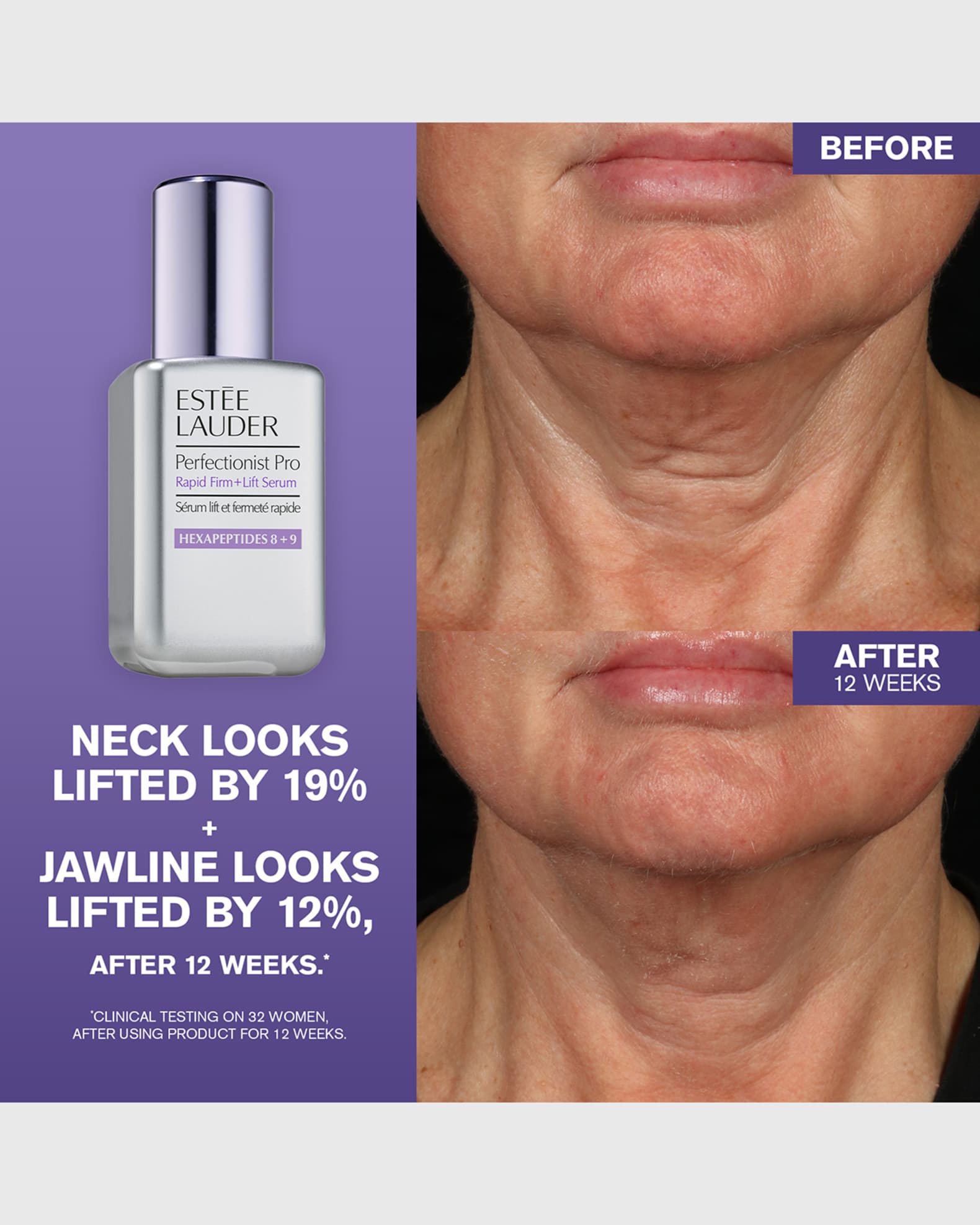 Estee Lauder Perfectionist Pro Rapid Firm + Lift Serum with ...