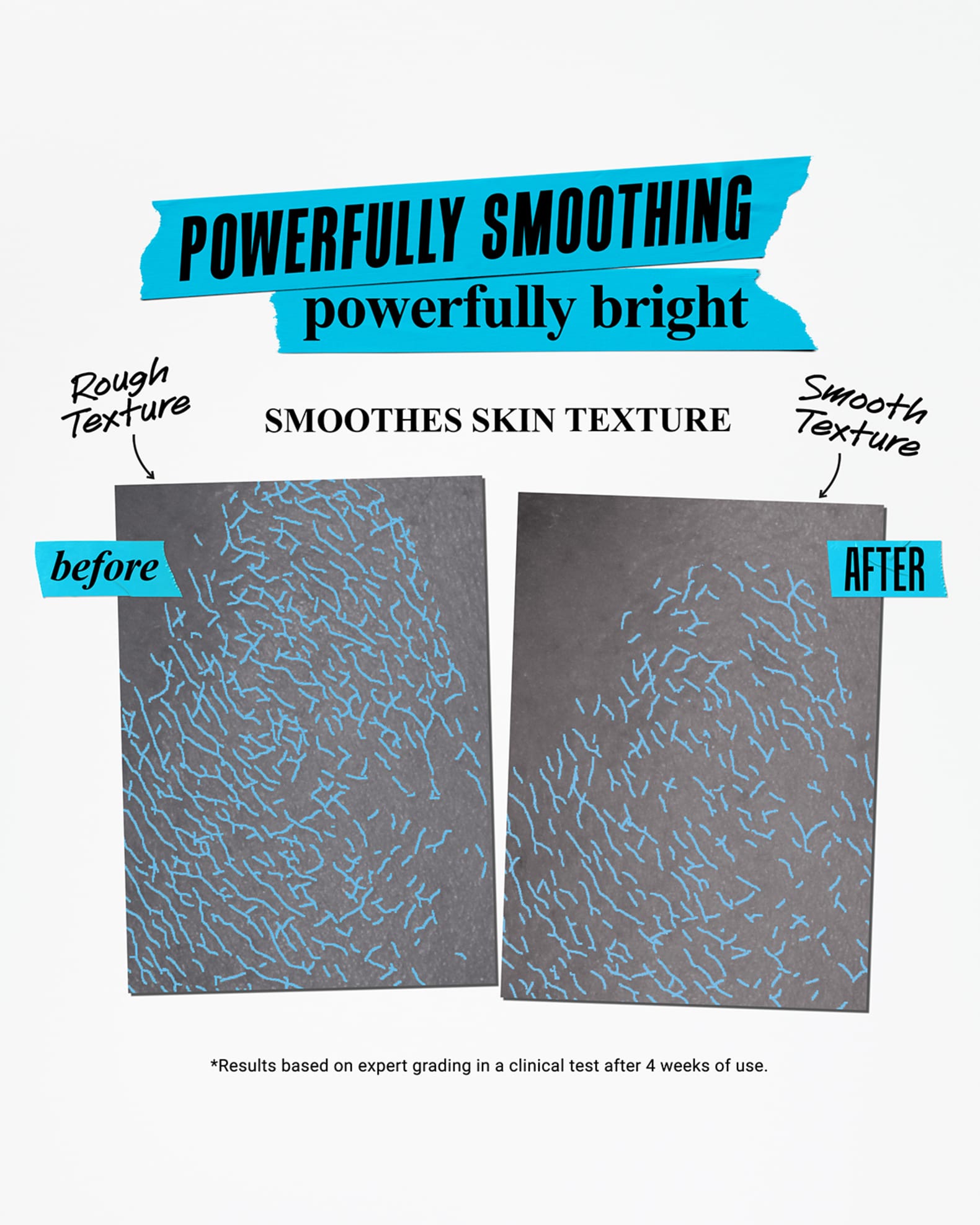 Kiehl's Since 1851 Clearly Corrective™ Daily Re-Texturizing Triple Acid Peel, 1 oz. | Neiman Marcus