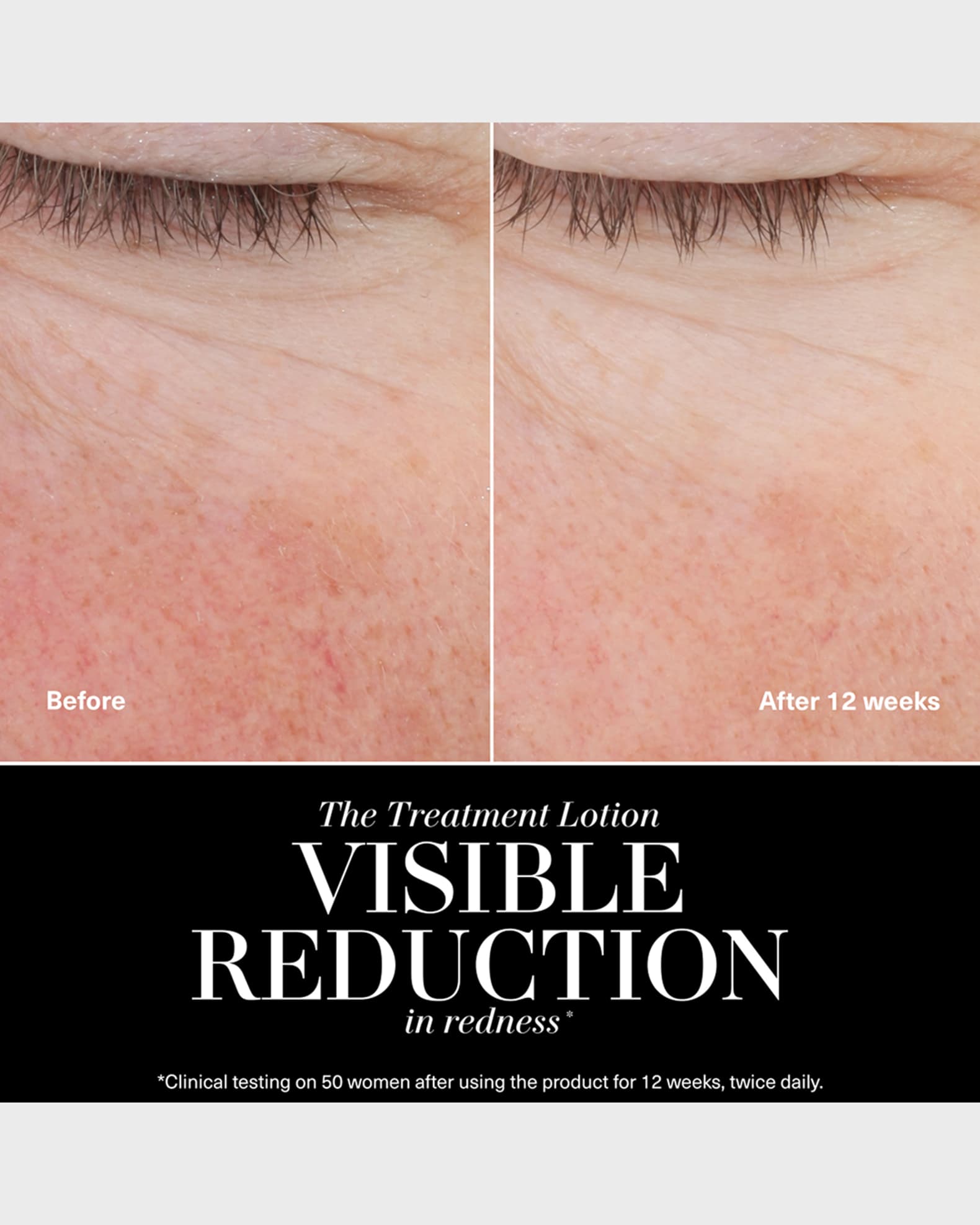 La Mer The Treatment Lotion, 6.8 oz. | Neiman Marcus