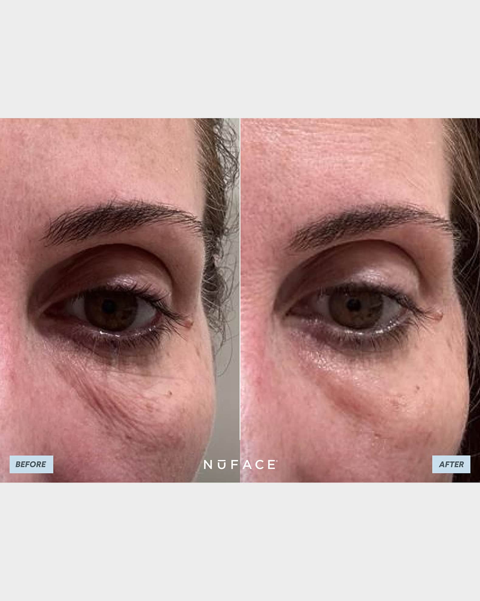 NuFace IonPlex HydraGel Eye Mask, 3.2 oz. | Neiman Marcus