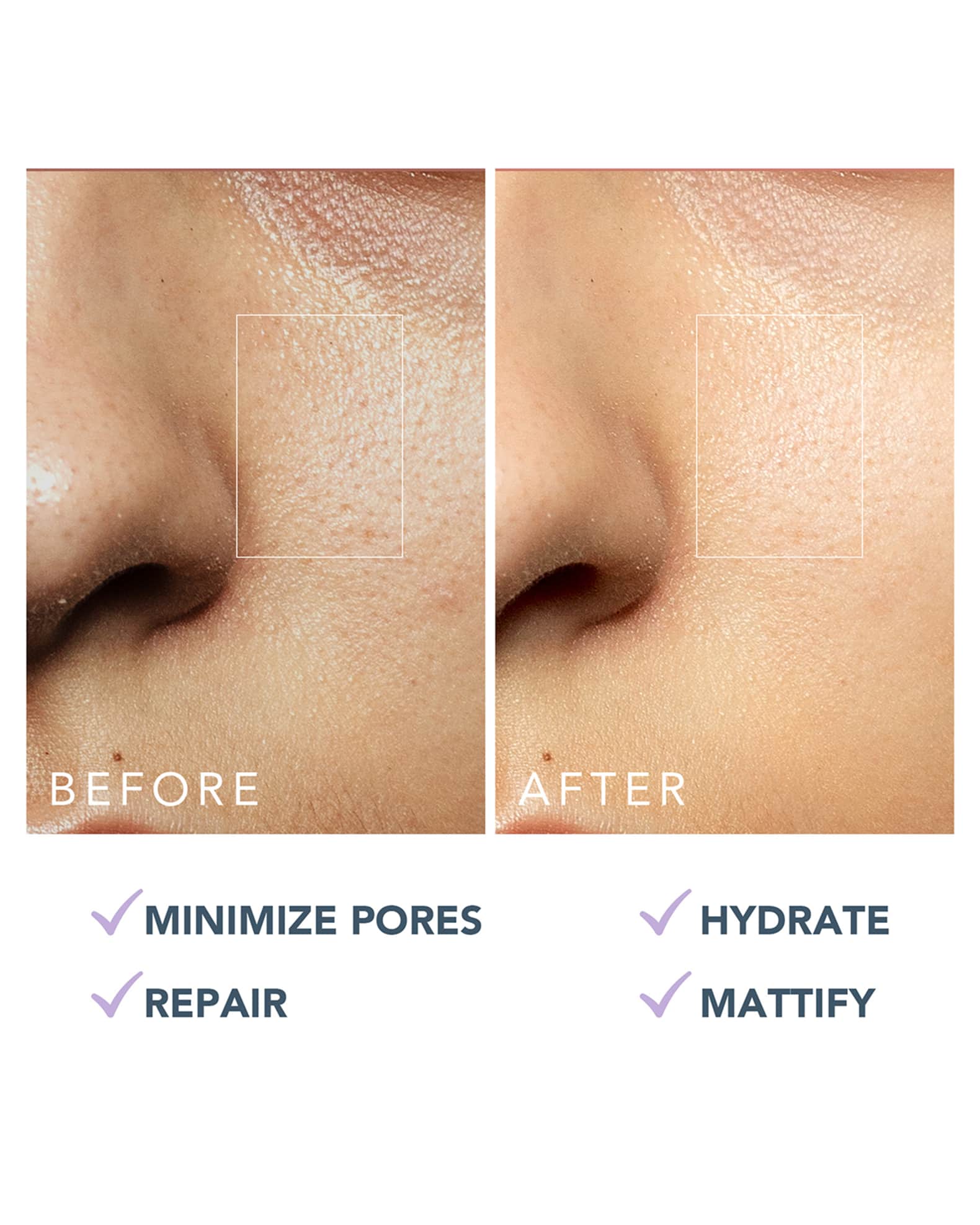 Foreo KIWI Oil Control Mattifying Moisturizer | Neiman Marcus