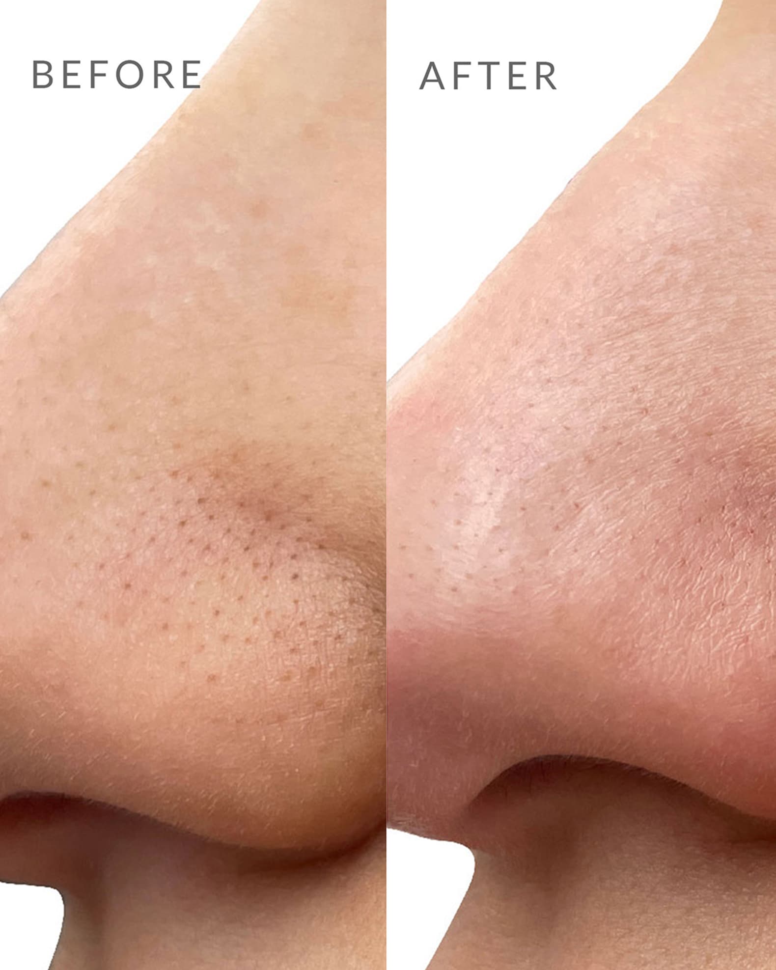 PMD Beauty Wave Pro Professional Grade Skin Spatula, 3.14 oz. | Neiman ...