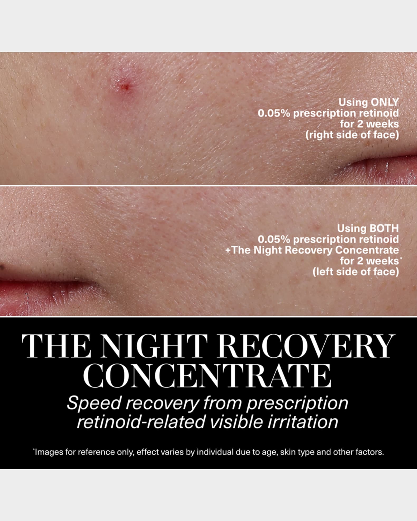 The Night Recovery Concentrate | Neiman Marcus