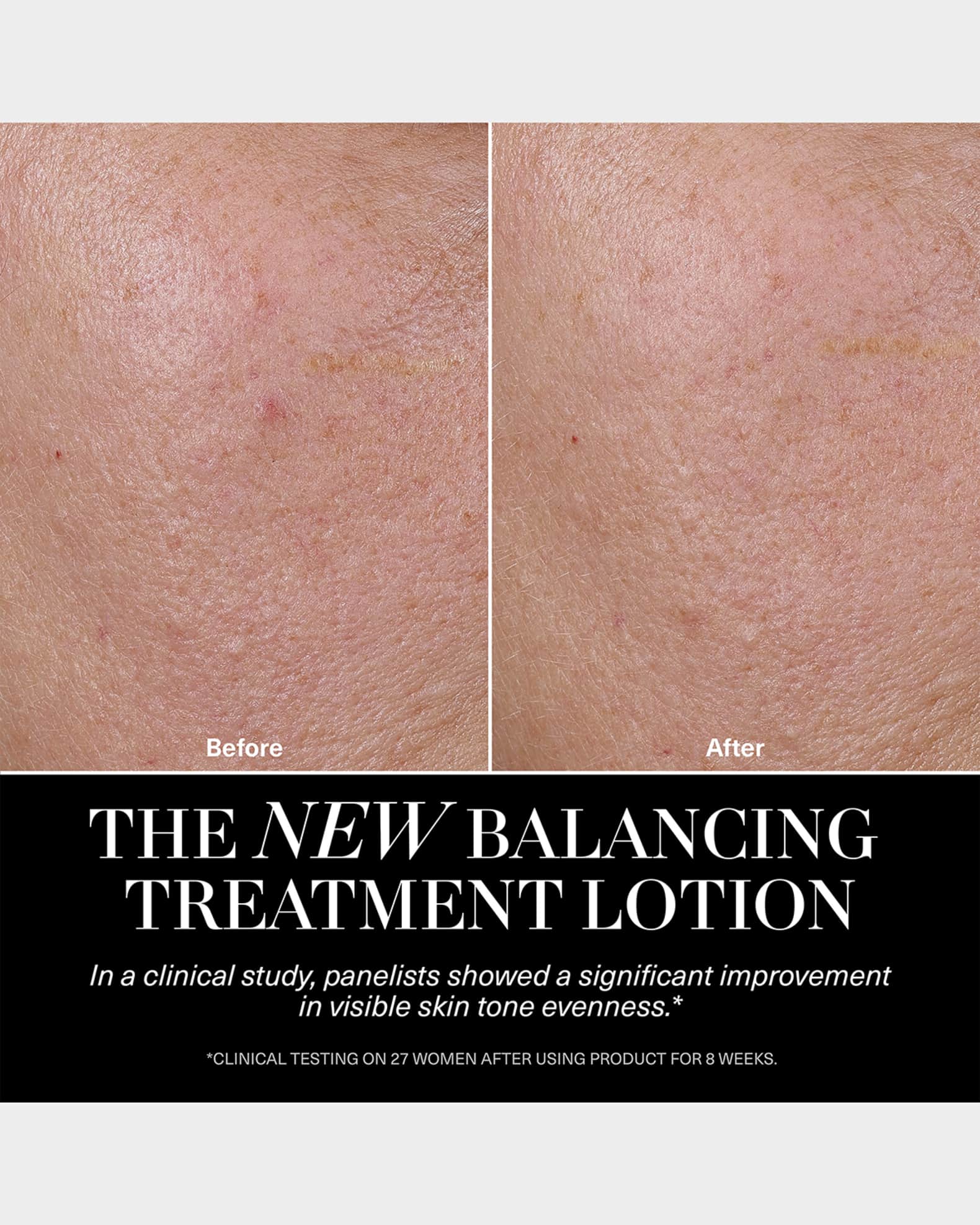 La Mer The Balancing Treatment Lotion, 5 oz. | Neiman Marcus